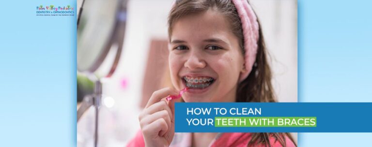 How to Clean Your Teeth with Braces? 10 Expert Advice