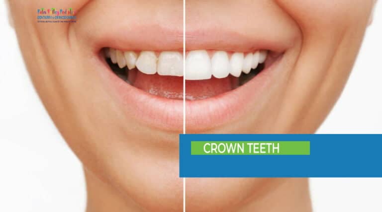 Crown vs Root Canal: Which Dental Procedure is Right for You?