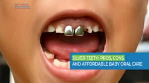 Silver Teeth: Pros, Cons, and Affordable Baby Oral Care