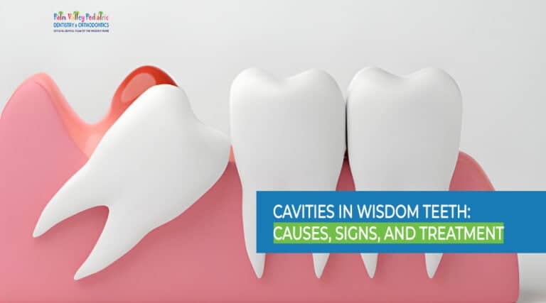 Cavities in Wisdom Teeth: Causes, Signs, and Treatment