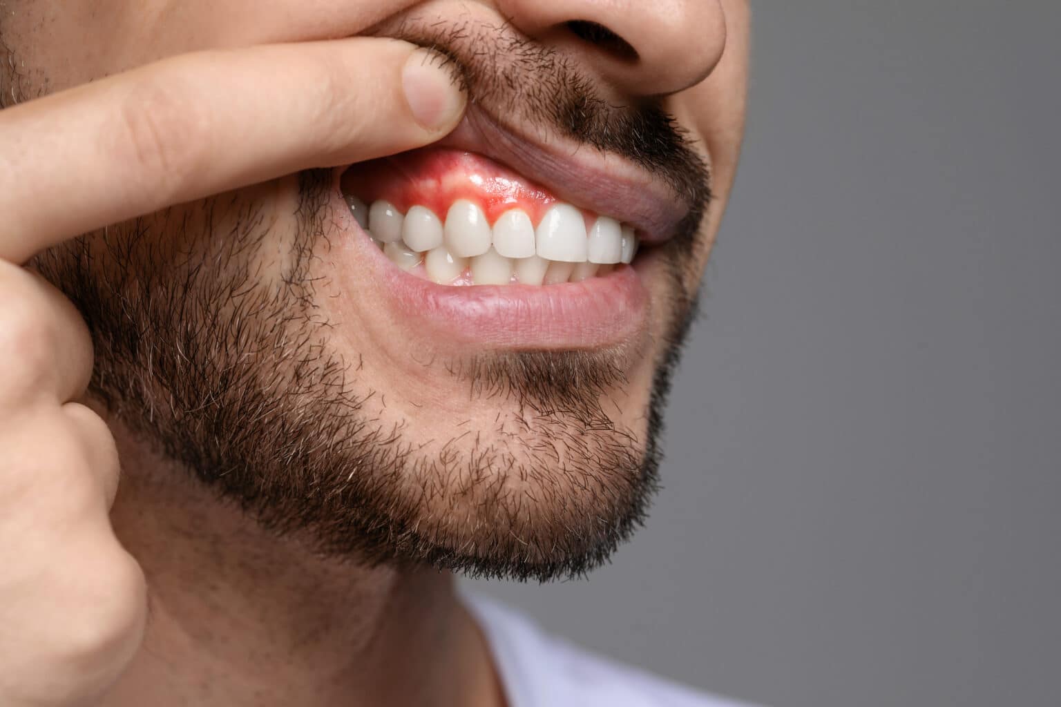 Dental Abscess Treatment for Healthy Gums in Arizona - PVPD